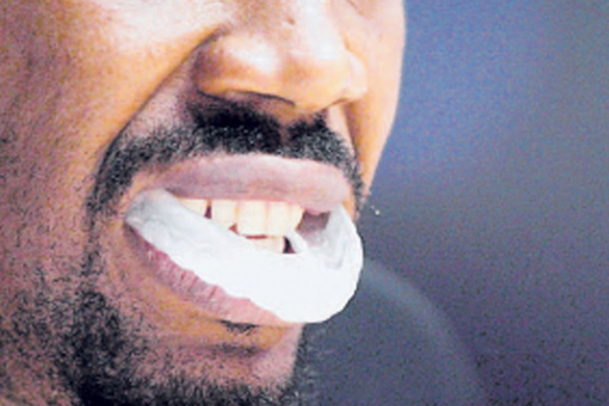 Here’s how you can protect your teeth from sports injuries | The Citizen