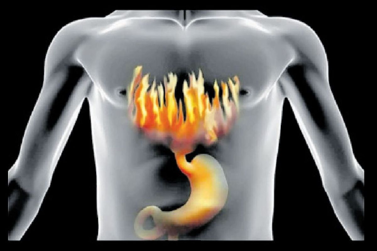 Watch that ‘burning’ sensation in your chest | The Citizen