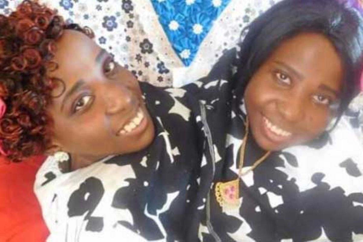 Conjoined twins Maria and Consolata, discharged from Muhimbili | The ...