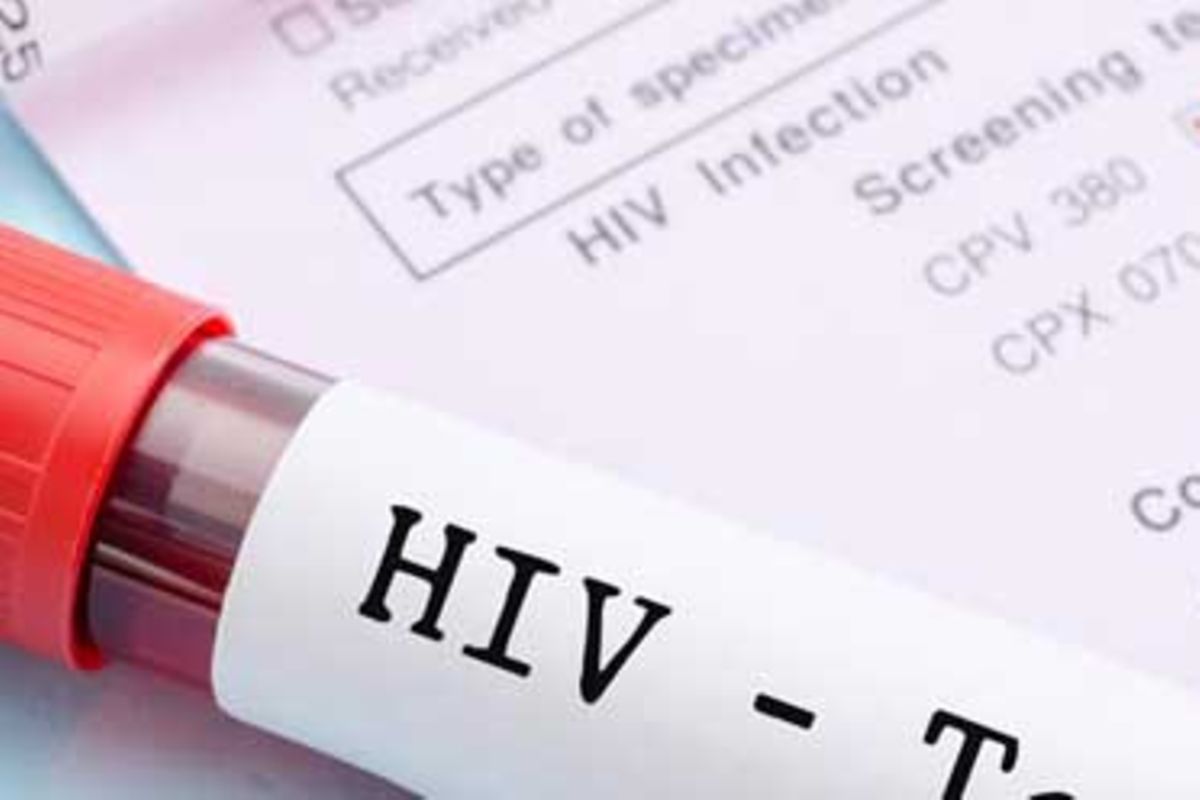 Study: New HIV drug Gammora is 99 per cent effective | The Citizen