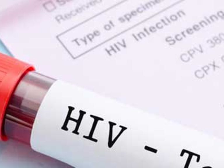 Study: New HIV drug Gammora is 99 per cent effective - The Citizen