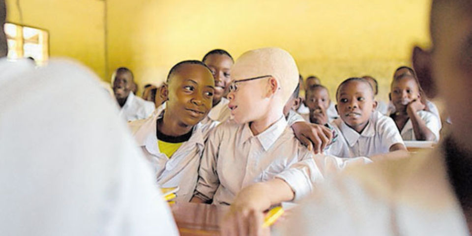 Education struggles of children with albinism | The Citizen