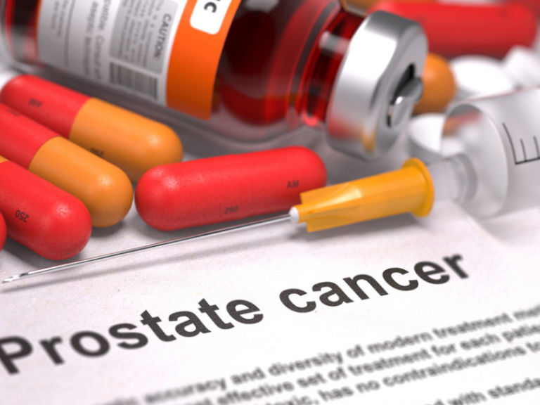 New prostate cancer drug unlocks key treatment - The Citizen