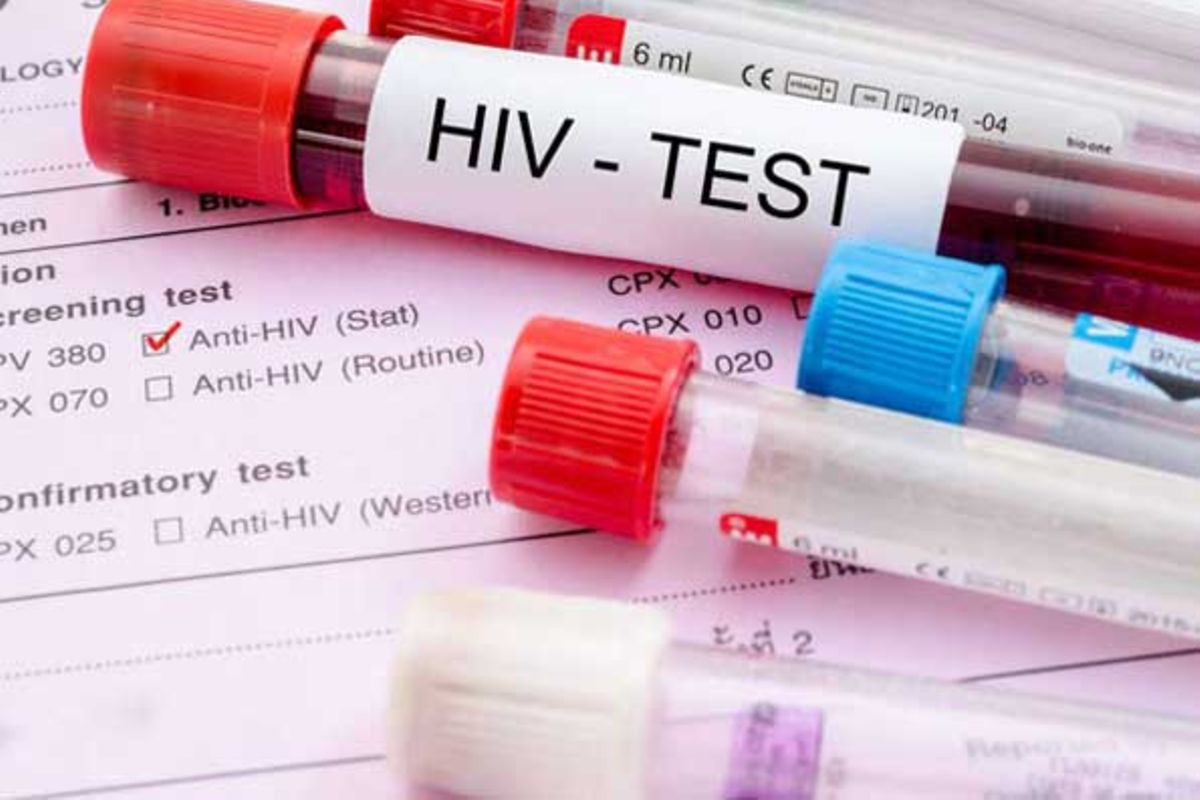 US lab identifies rare new HIV strain | The Citizen