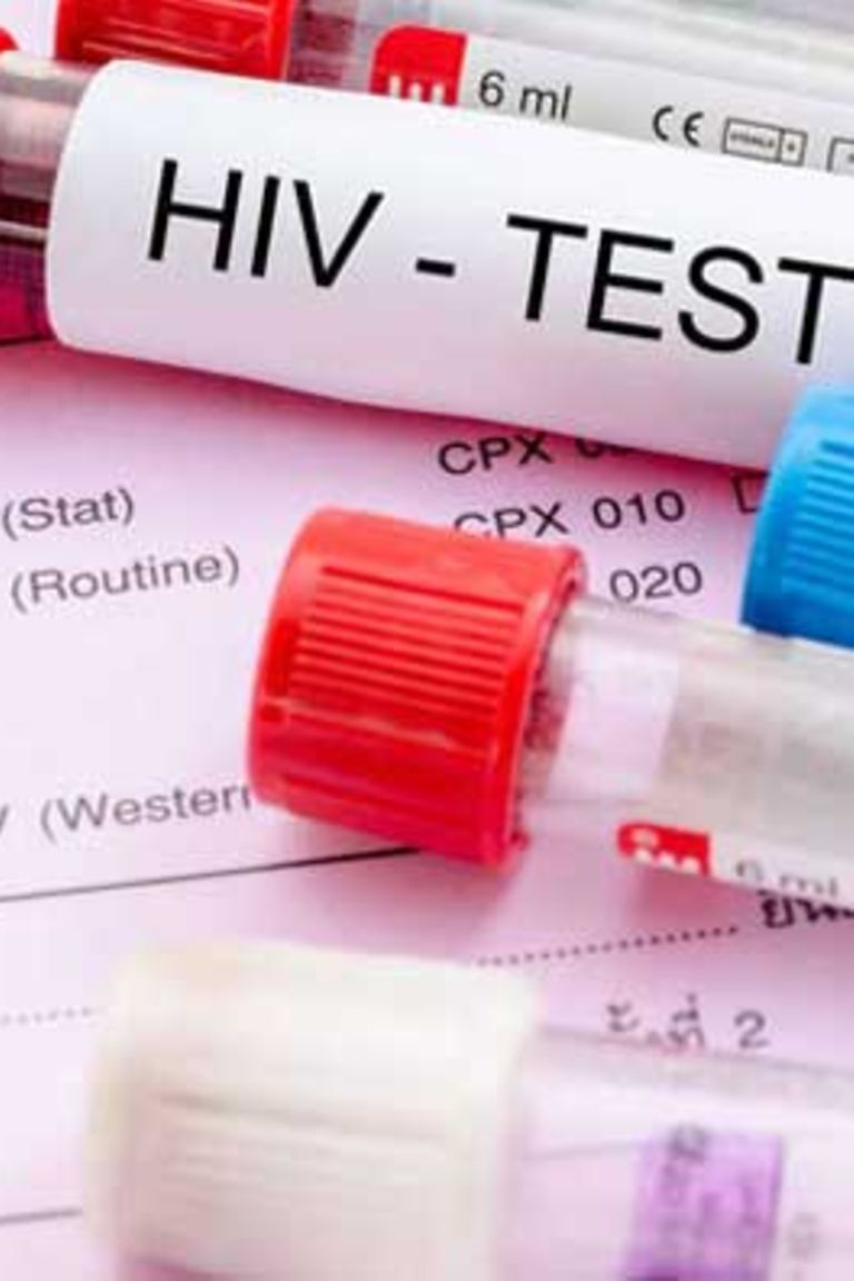 US lab identifies rare new HIV strain - The Citizen