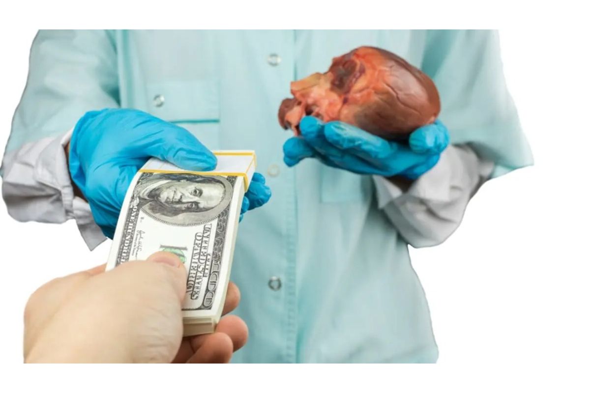 Here’s why you can’t offer that kidney for sale | The Citizen