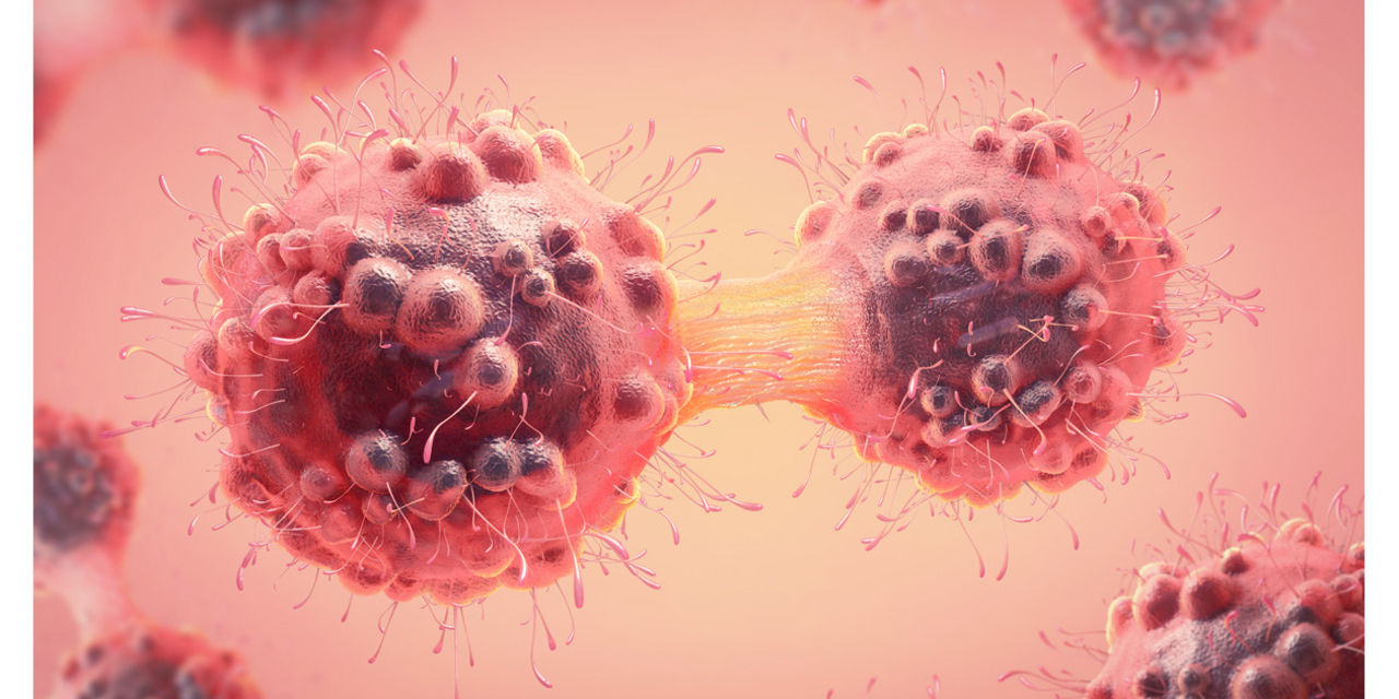 Cancer cases on the increase as Kilimanjaro leads in incidence | The ...