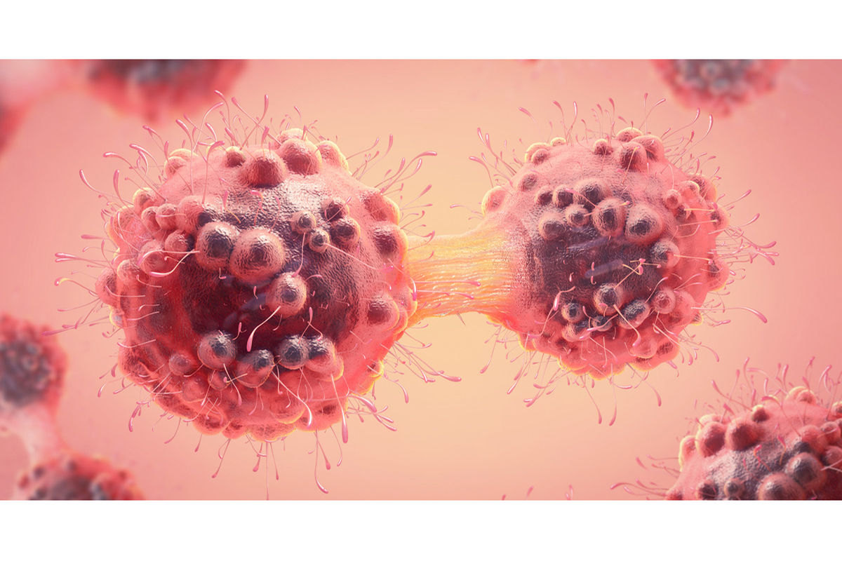 Cancer cases on the increase as Kilimanjaro leads in incidence | The ...